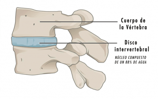 ¿Una protusión discal puede desaparecer? | JL FISIOS