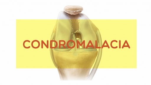 ᐉ ¿Es bueno andar para la condromalacia rotuliana?
