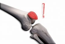 Rótula: Anatomía, biomecánica y lesiones con FOTOS