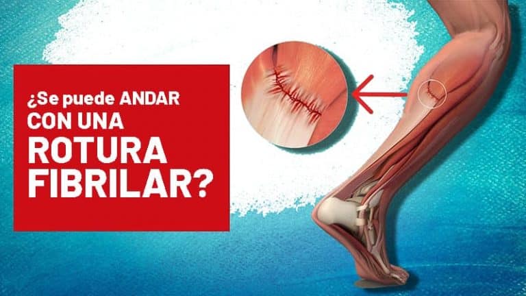 ¿Se puede andar con rotura de fibras en el gemelo? | JL FISIOS