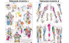 Mapa de los Puntos Gatillo, qué son y cómo tratarlos | JL FISIOS