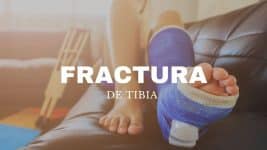 Fractura de Troquíter: Dolor, tratamiento y tiempo de recuperación | JL ...