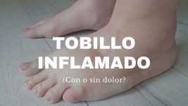 Tobillo hinchado con o sin dolor: ¿cuáles son las causas más comunes y ...