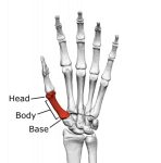 Cómo identificar y tratar las fracturas en el dedo pulgar: Consejos de ...